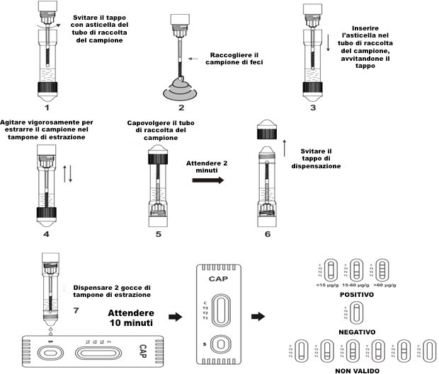TEST CALPROTECTINA - CF 10 TEST - NobelMed